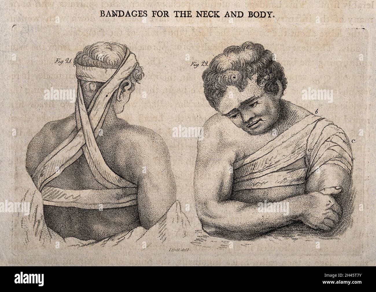 The upper body and head and ways of bandaging them. Stipple engraving by J. Bell Stock Photo - Alamy