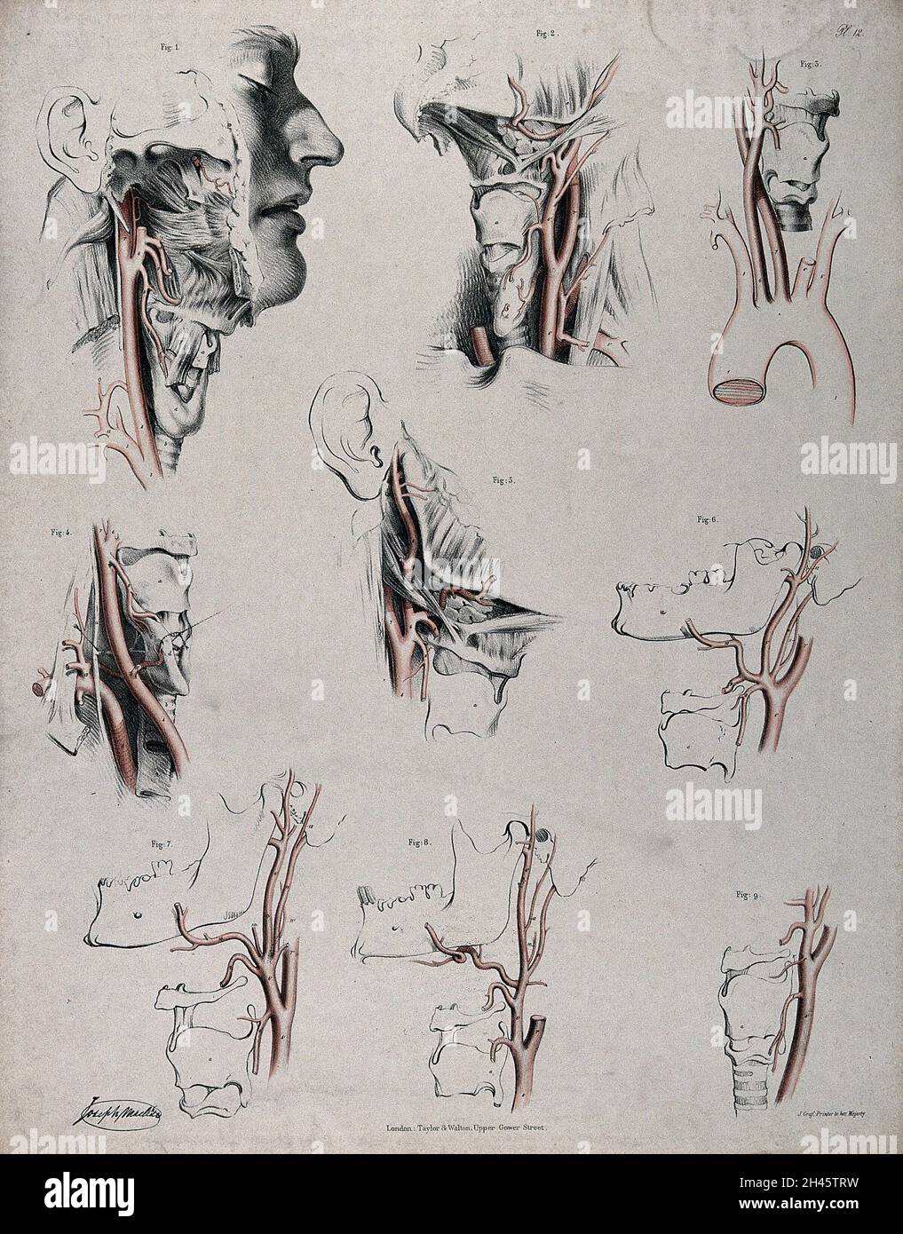 The circulatory system: dissections of the neck and jaw of a man, with ...