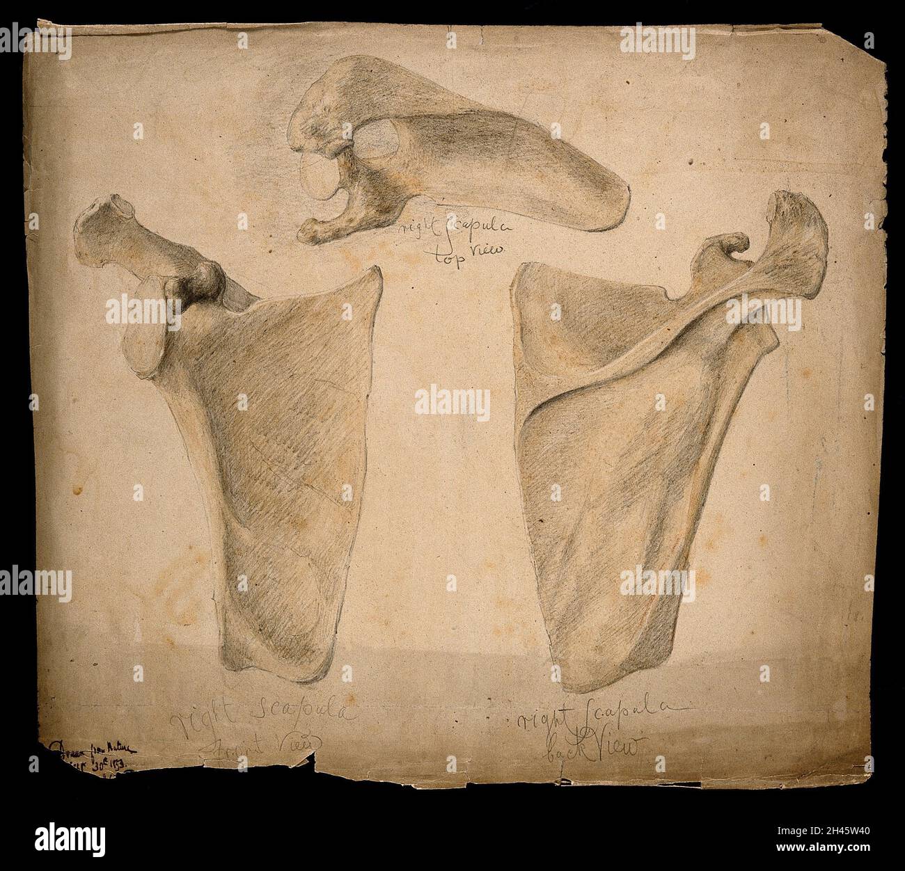 The right scapula: three figures. Watercolour, pencil and crayon ...