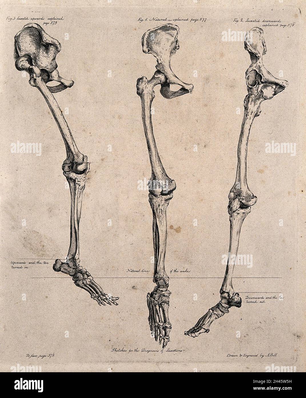 Three skeletal legs with pelvis and foot attached. Etching by J. Bell ...