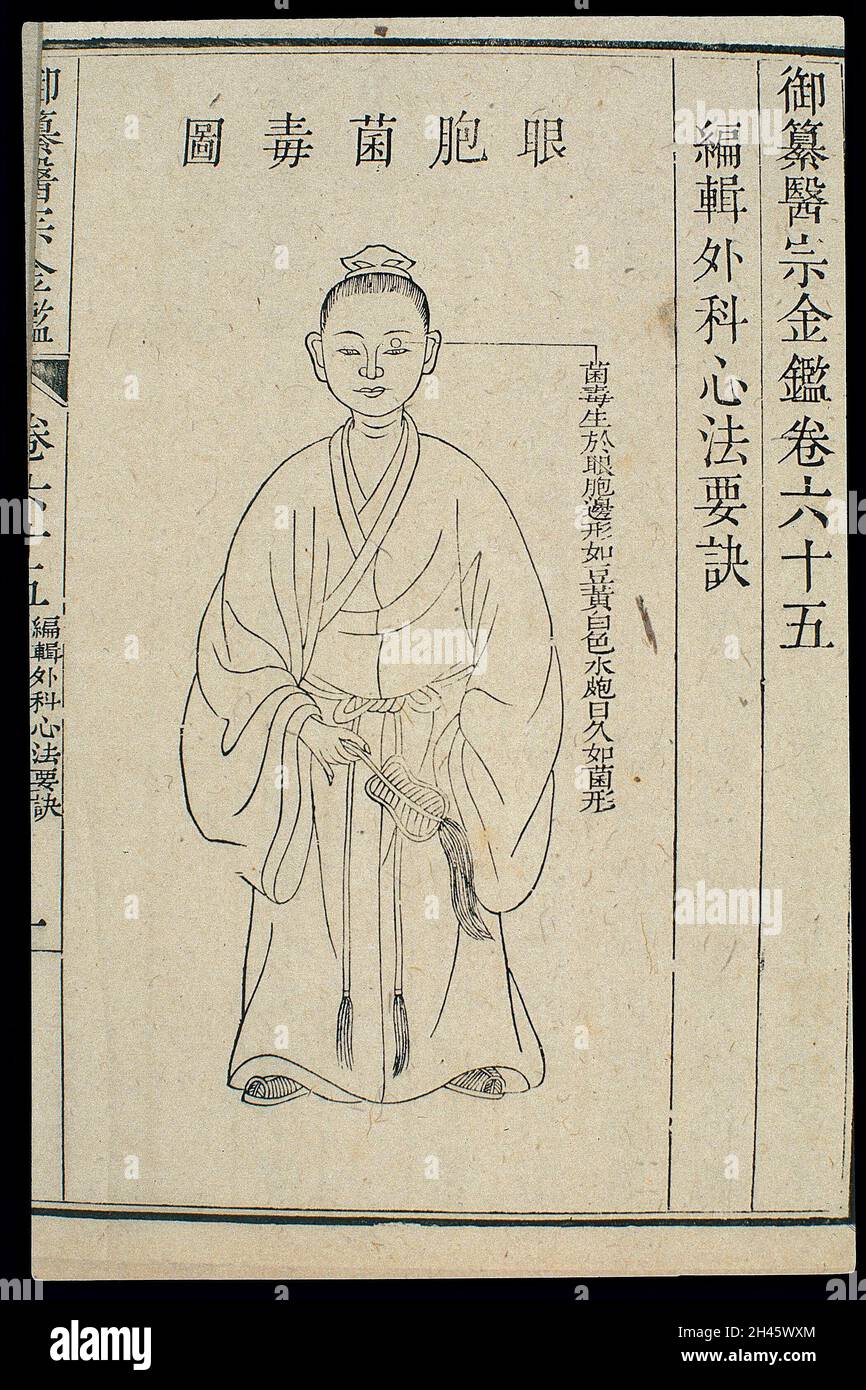 Chinese C18 woodcut: External eye - Infected eyelids Stock Photo - Alamy