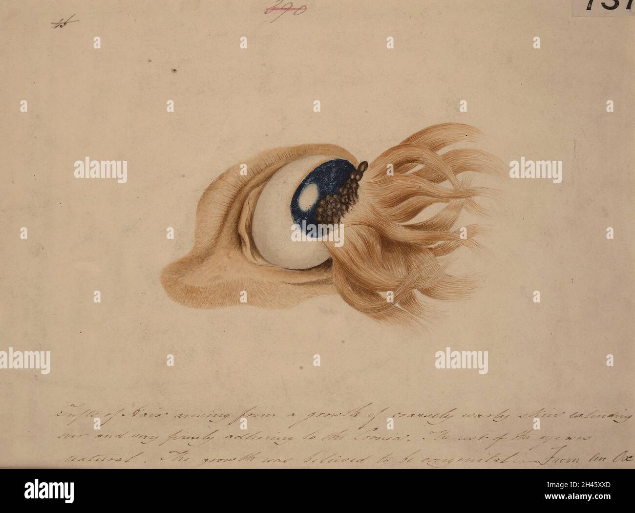 Ox eye with a growth of warty skin bearing tufts of hair, extending ...