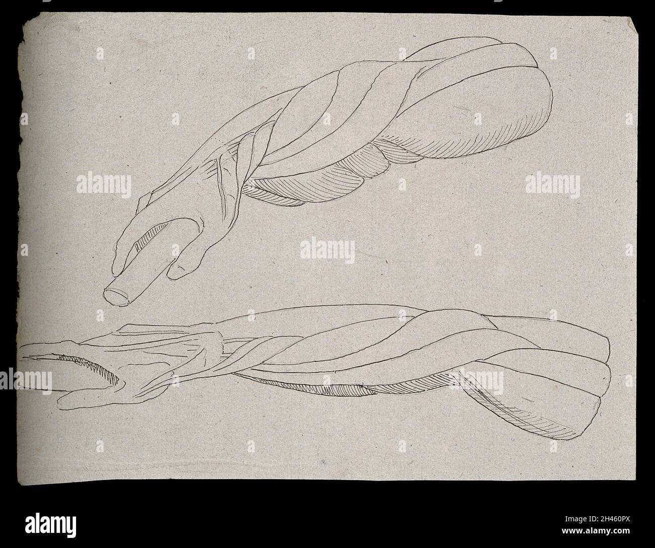 Muscles of the arm and hand: four figures (two on verso), showing the ...