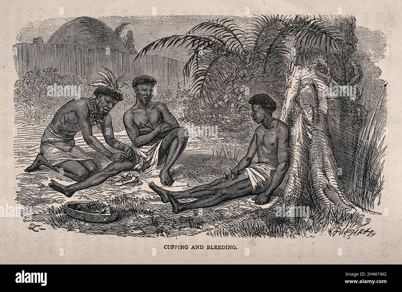 African leech hi-res stock photography and images - Alamy