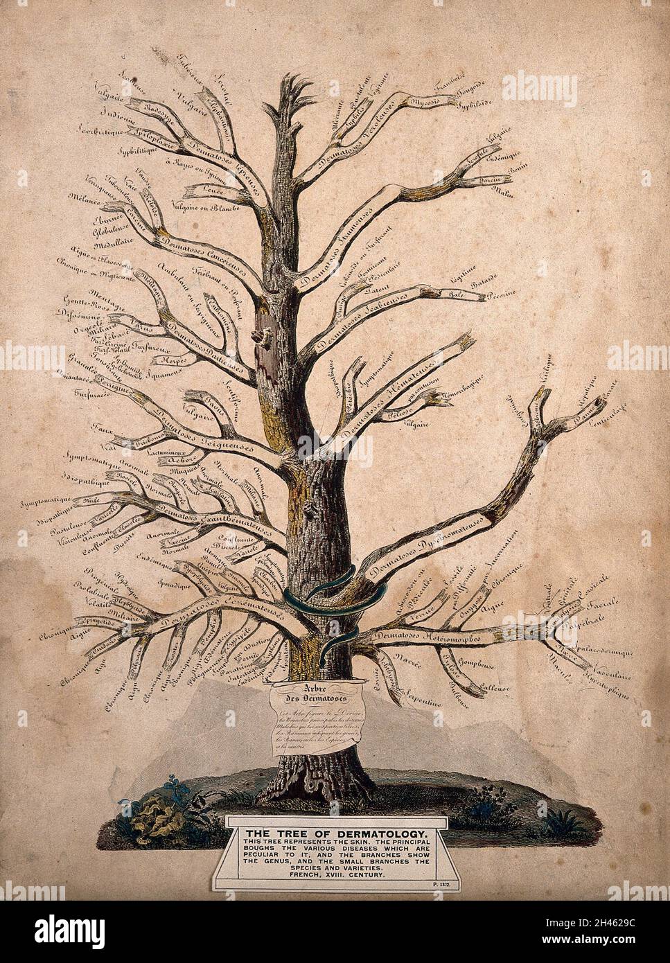A family tree of skin diseases. Coloured engraving, c. 1835 Stock Photo ...