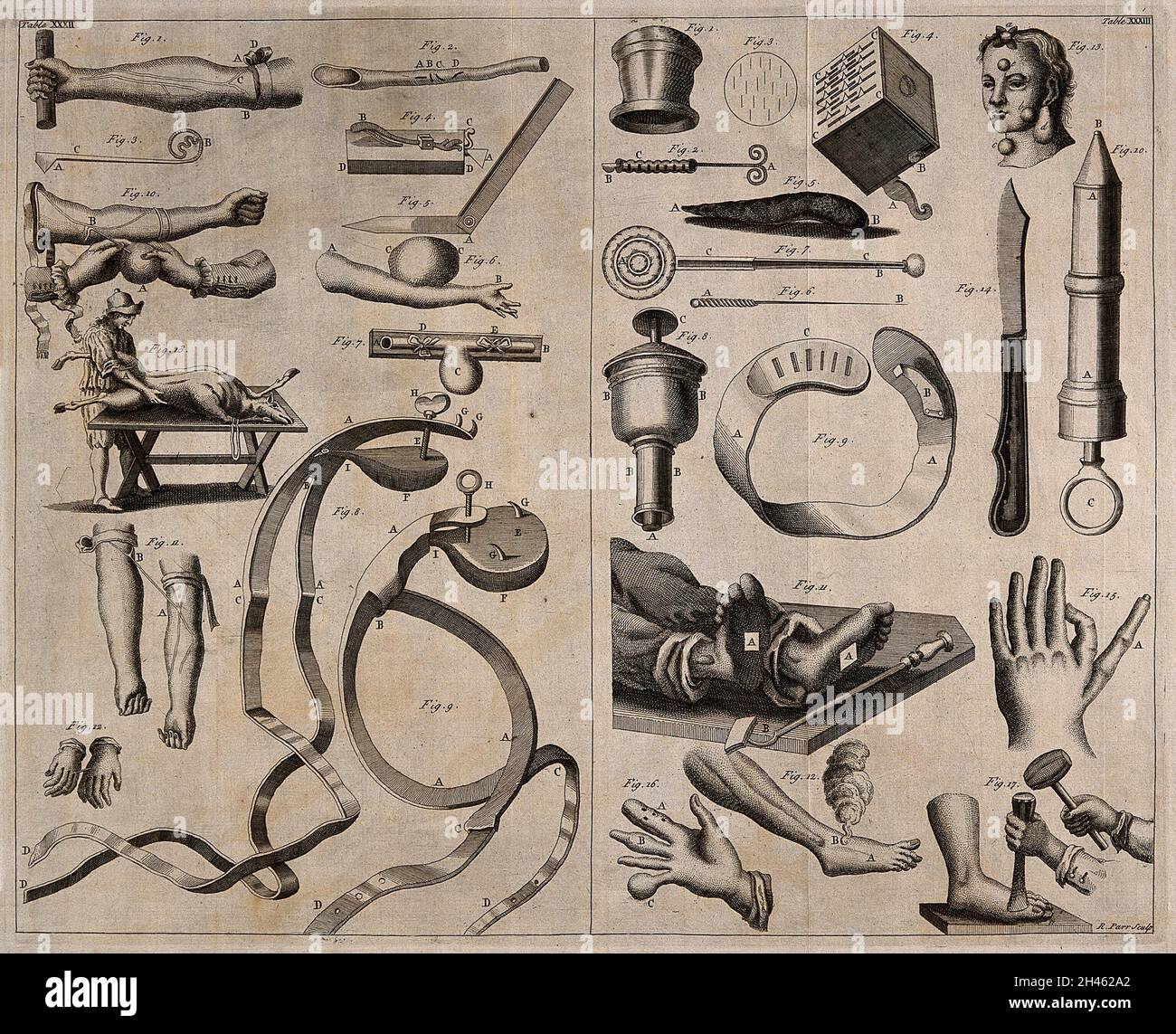 Surgical instruments. Engraving with etching by R. Parr Stock Photo - Alamy