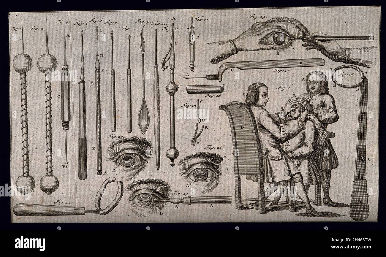 Surgical instruments and patients undergoing treatment. Engraving with ...