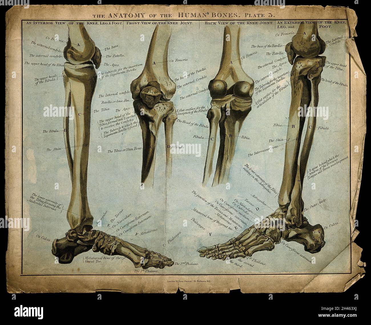 Bones of the lower limb, knee and foot: four figures. Coloured stipple ...