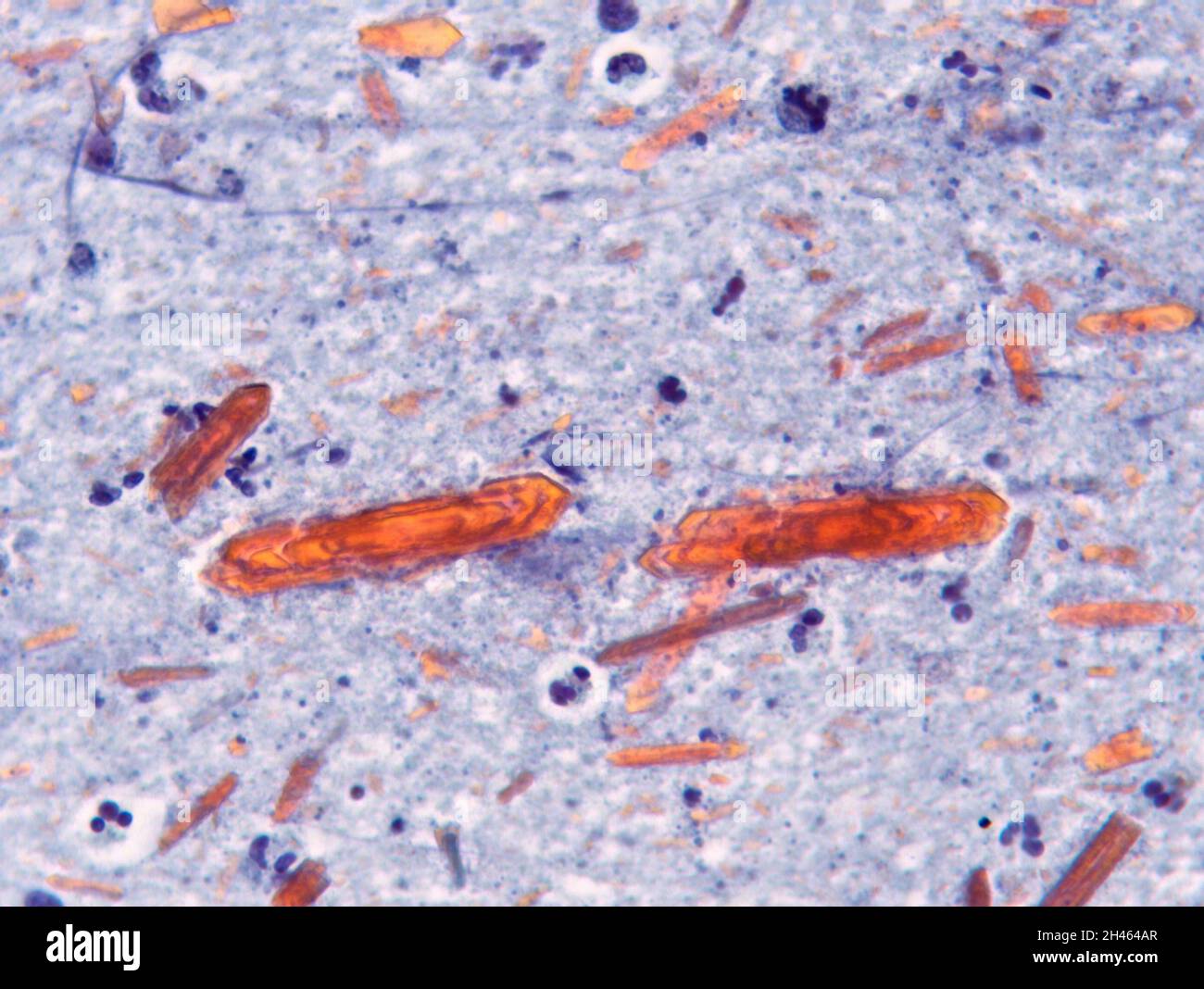 Amylase High Resolution Stock Photography and Images - Alamy
