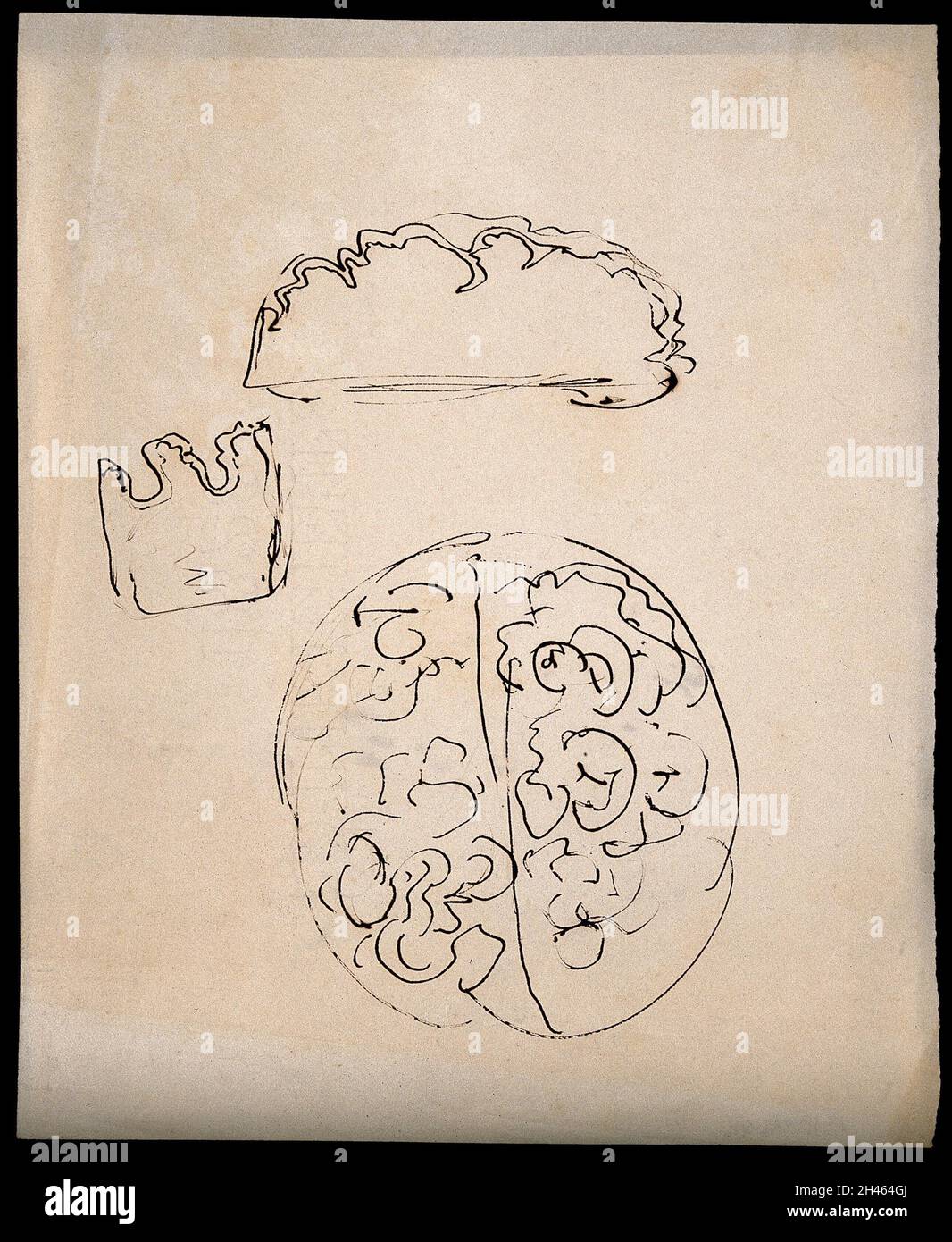 A brain; and two sections of brain (?). Drawing Stock Photo - Alamy