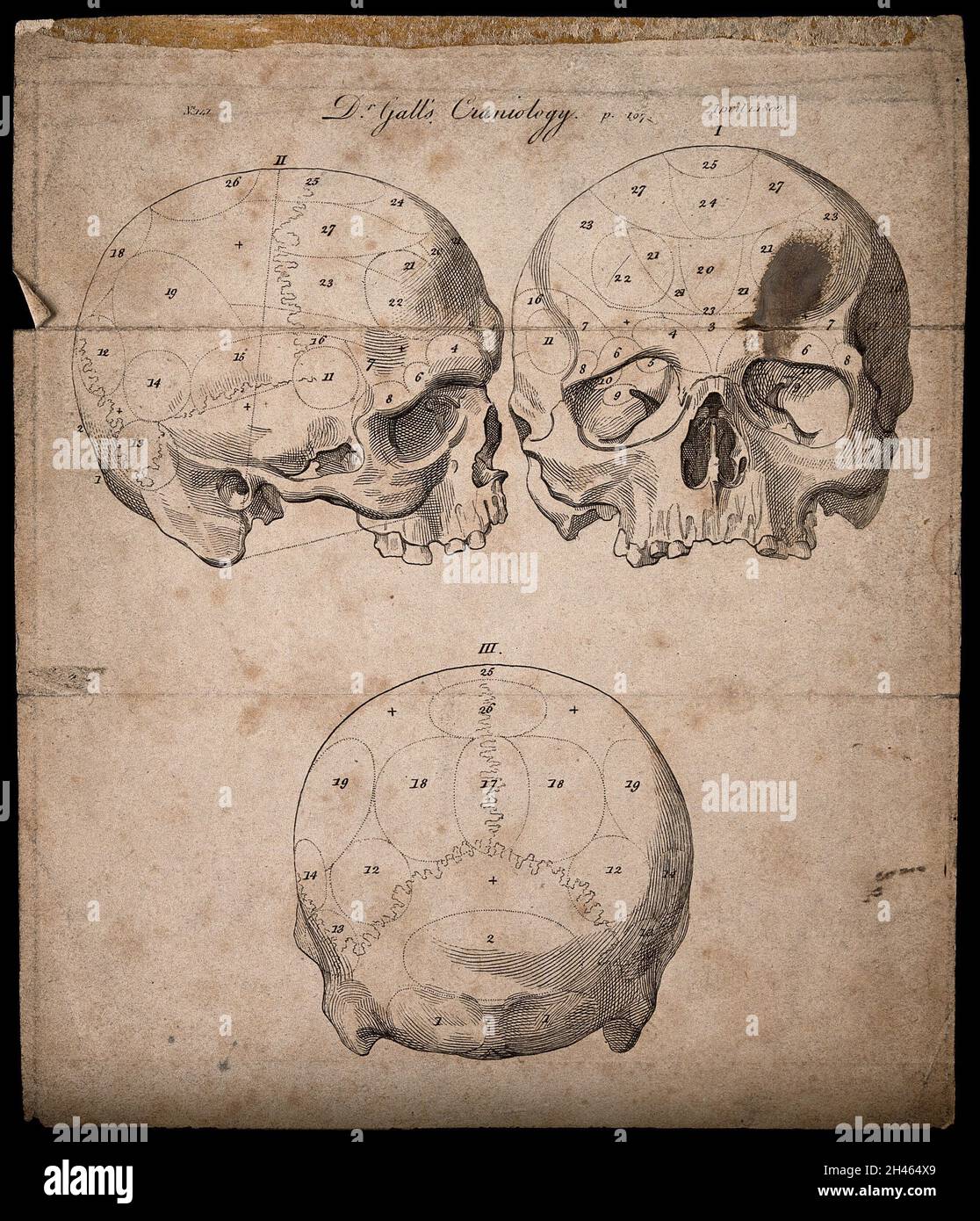 Three perspectives of a skull sectioned and numbered according to Gall ...