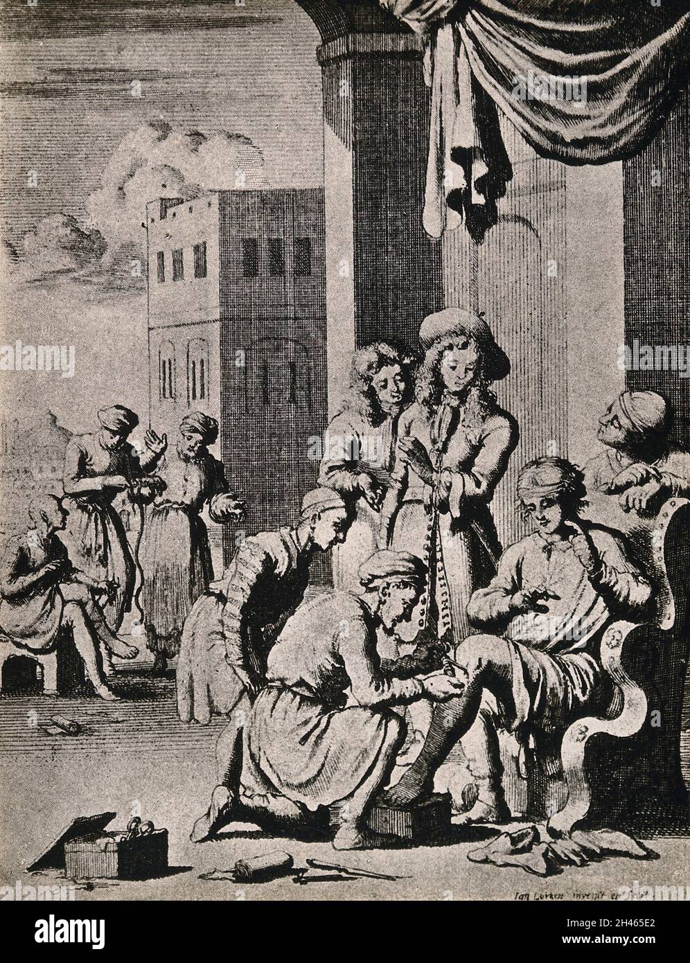 A surgeon extracting a guinea worm from a man's leg, in the background ...