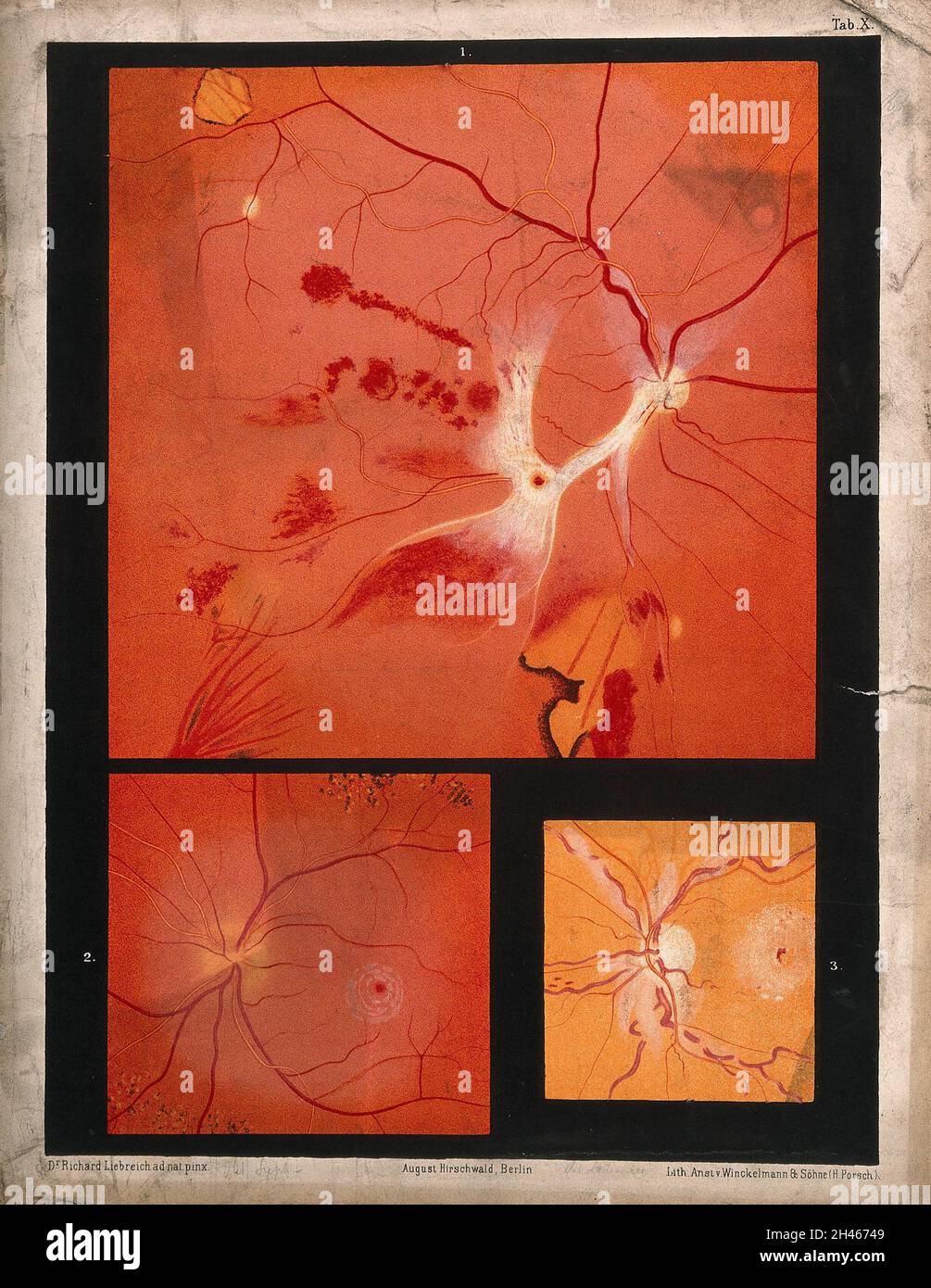 The eye, as seen through a microscope: three figures. Colour lithograph ...