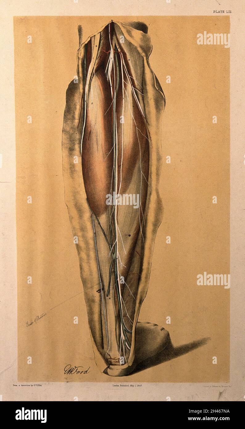 Dissection of the back of the lower leg, showing the muscles, blood ...