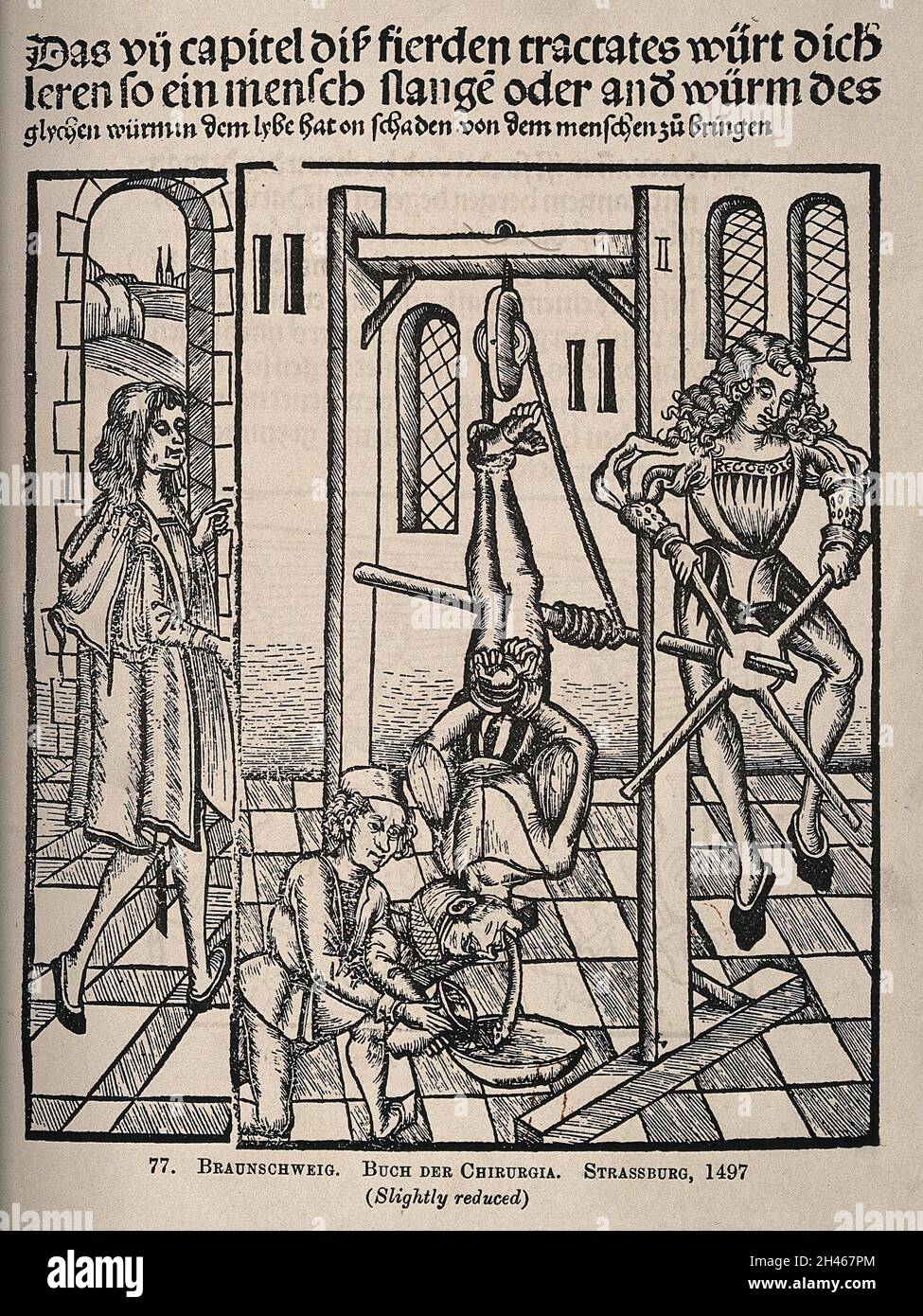 A male patient is hanging by his feet from an apparatus, a large worm ...