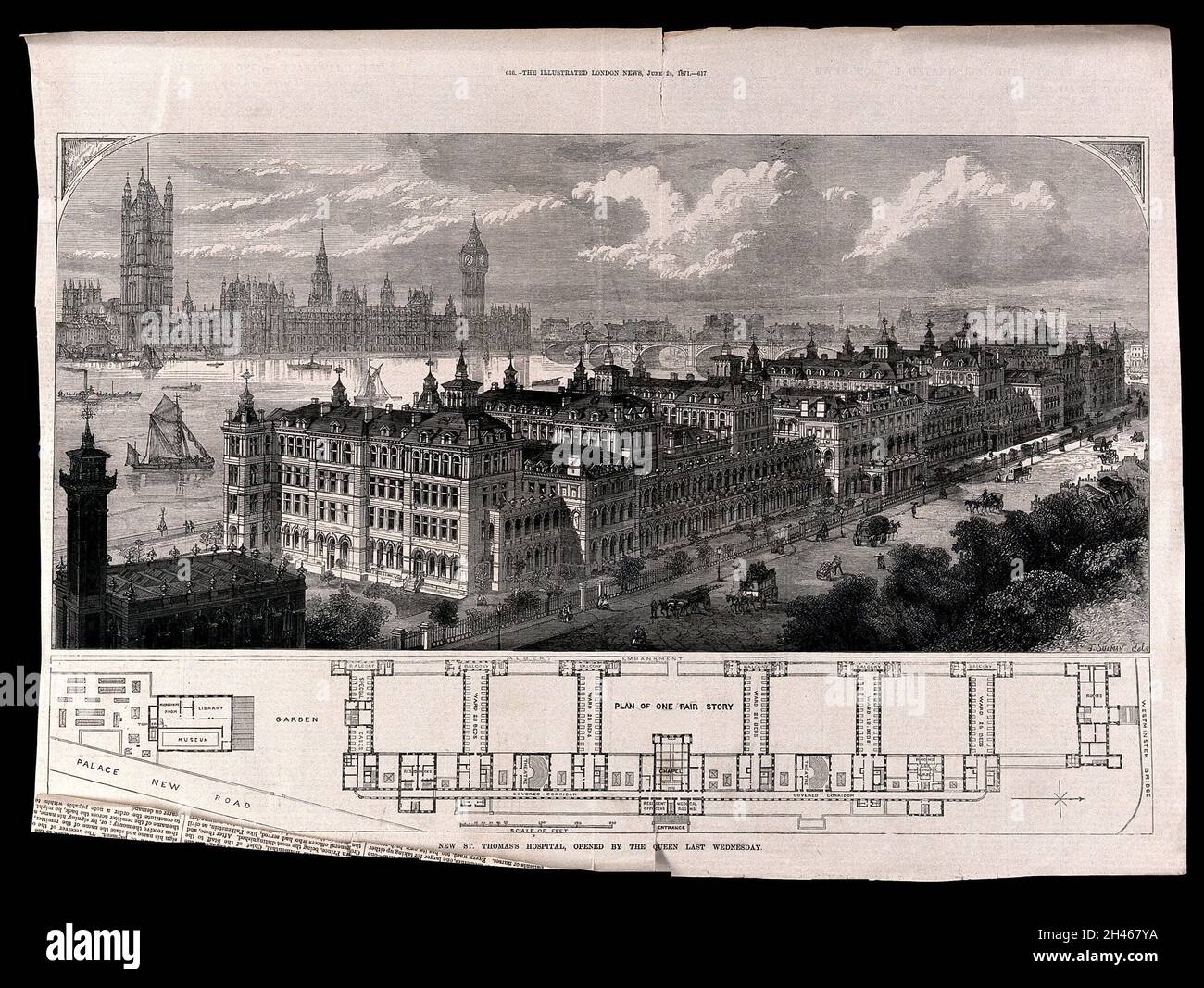 Saint Thomas's Hospital, Lambeth, seen from the south-east with the ...
