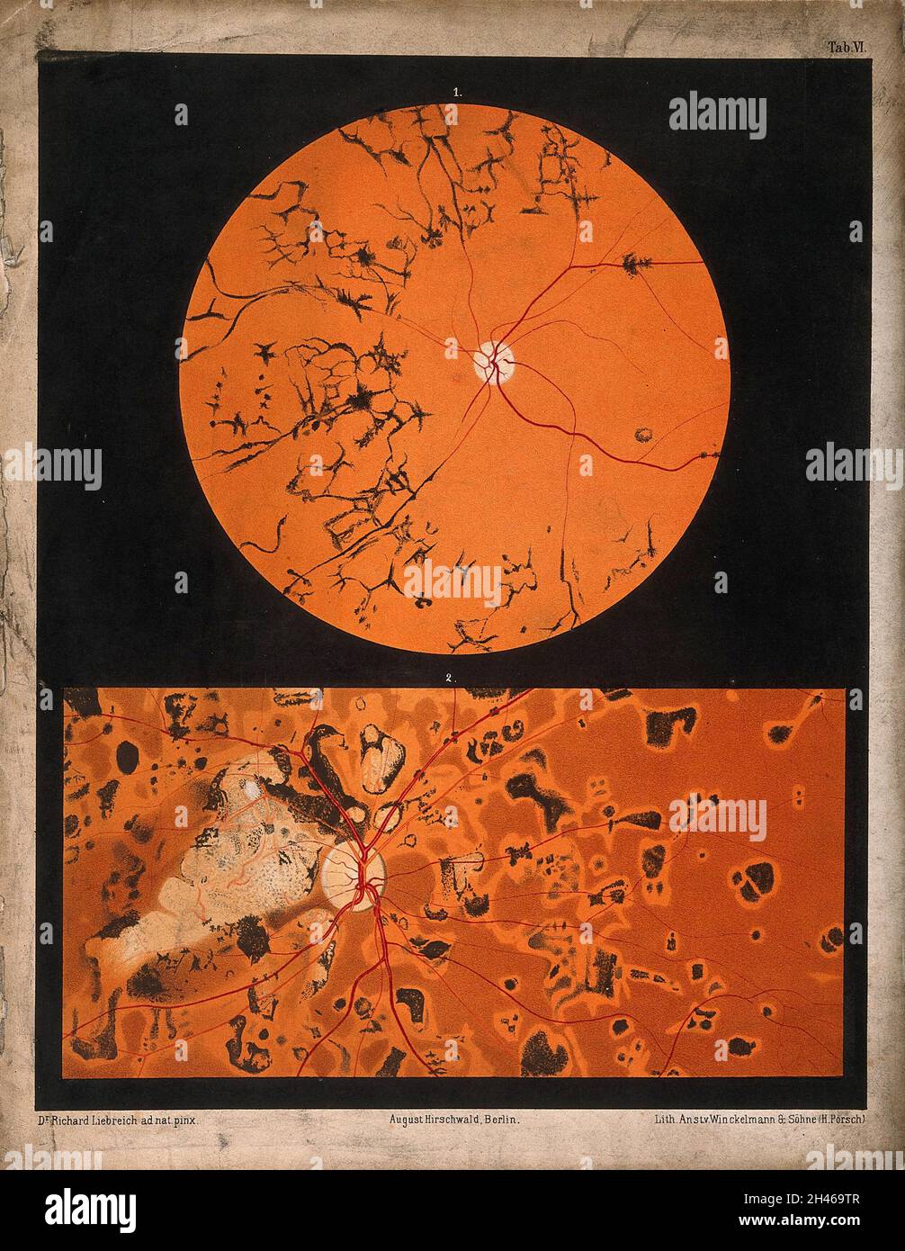 The eye, as seen through a microscope: two figures. Colour lithograph ...