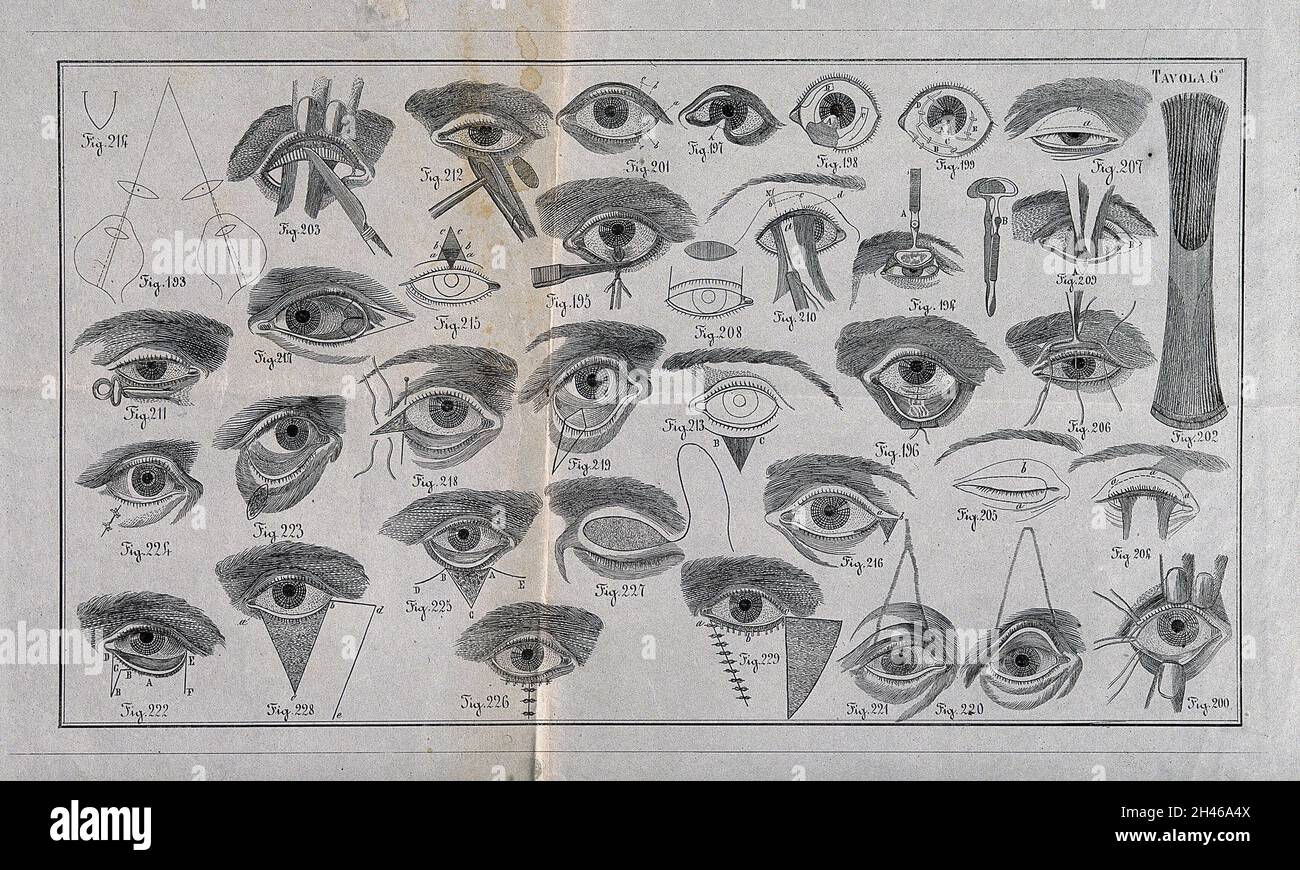 A sheet of eye examinations and diagrams of the eye with a numbered key ...