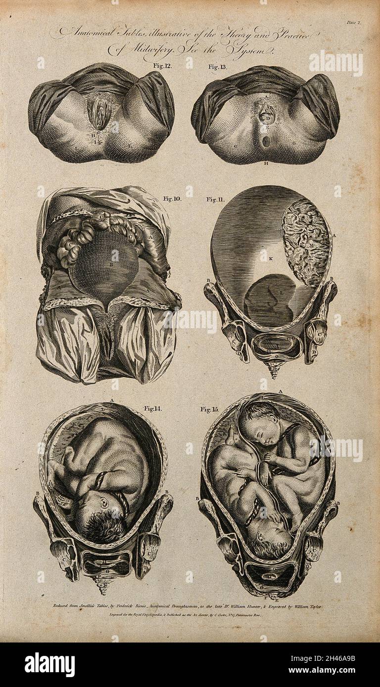 Female genitalia and uterus during pregnancy: six figures, including ...