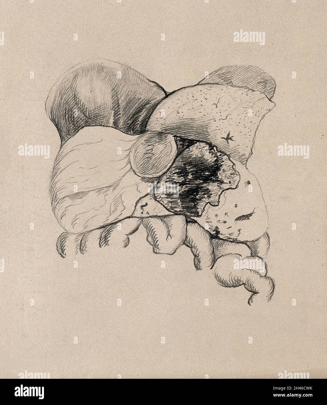 A diseased part of the body. Drawing, c. 1803 Stock Photo - Alamy
