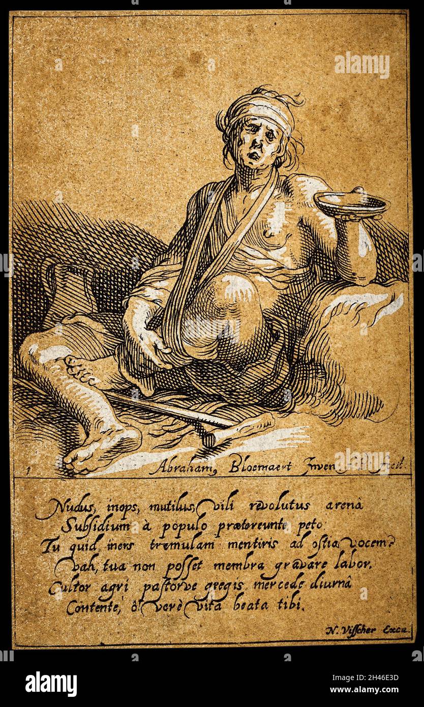 A lame man sitting on the ground with his injured leg in a sling ...