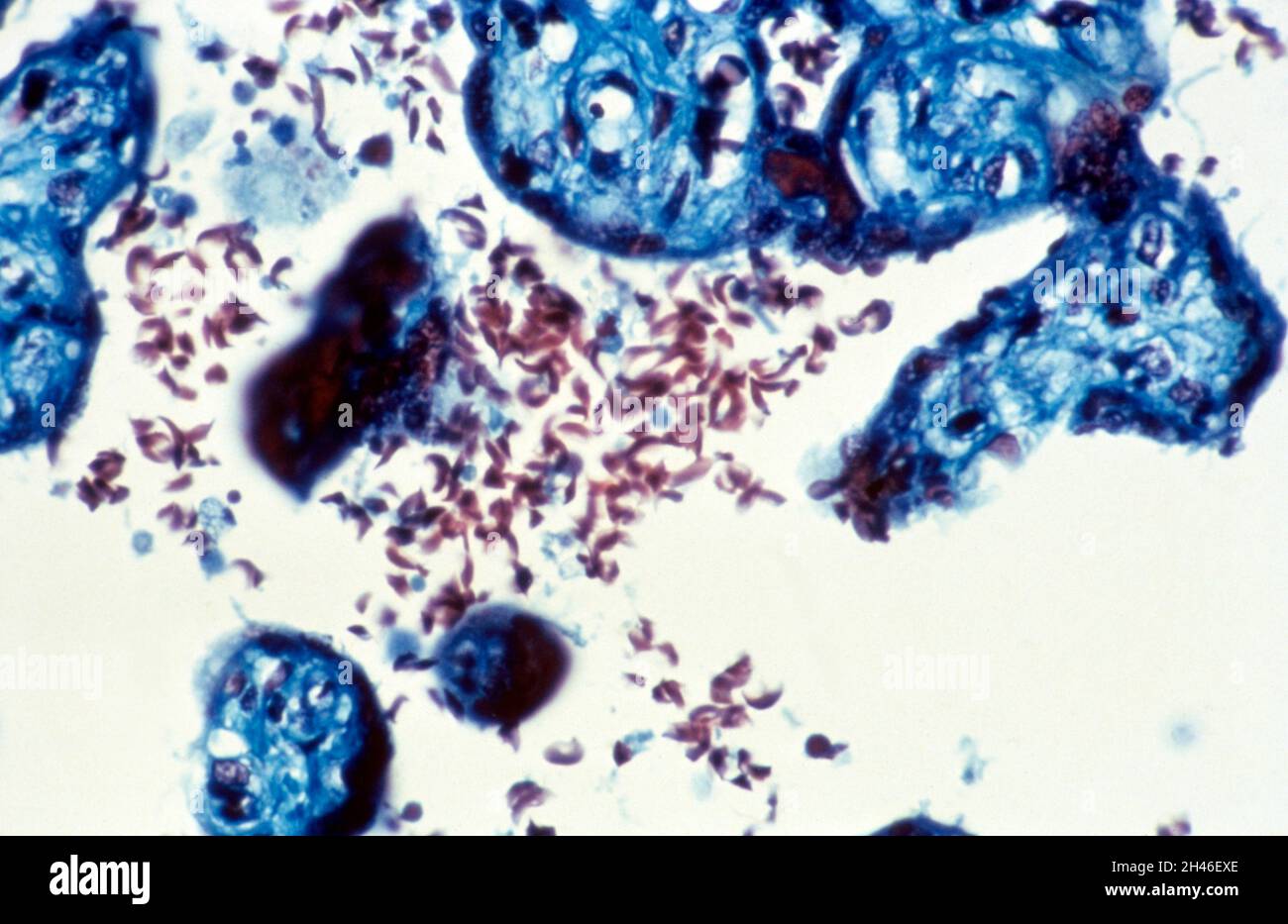 Placenta structure hi-res stock photography and images - Alamy