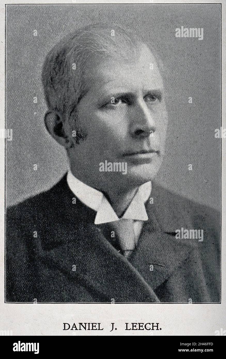 Leech daniel hi-res stock photography and images - Alamy