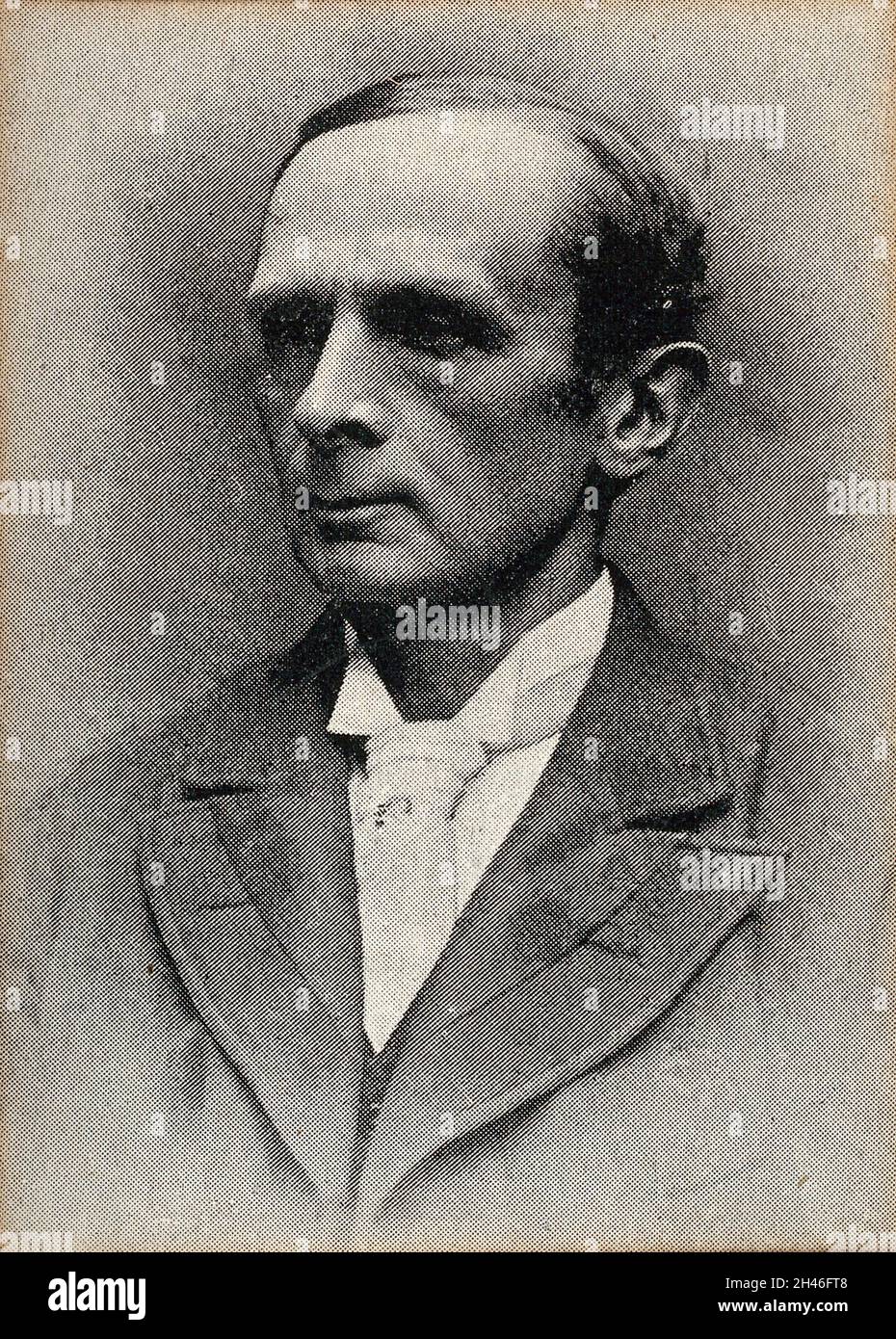 Morell mackenzie hi-res stock photography and images - Alamy