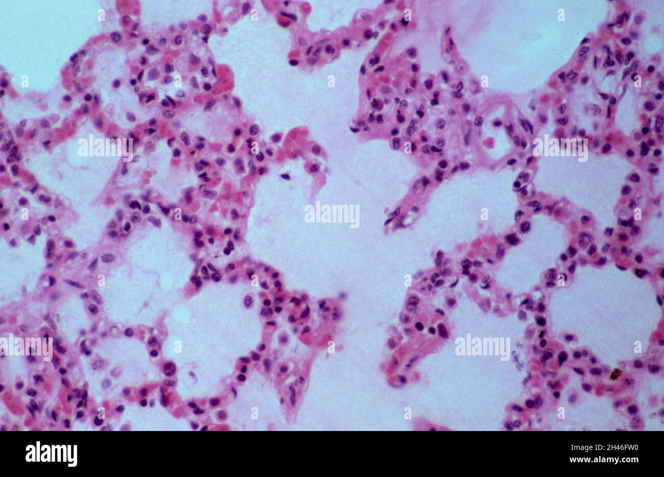 Plasmodium Slide Labeled