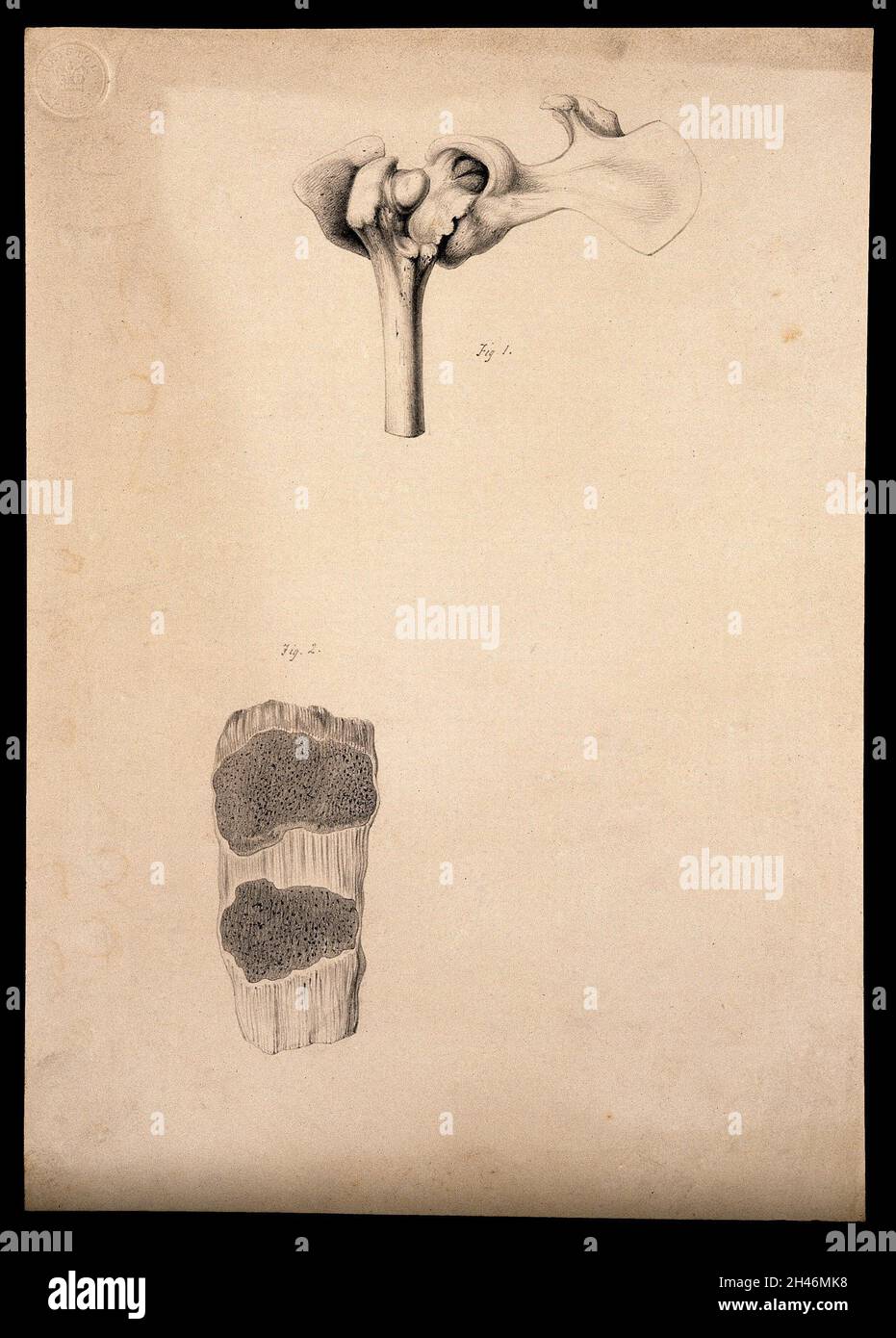 Dislocated patella hi-res stock photography and images - Alamy