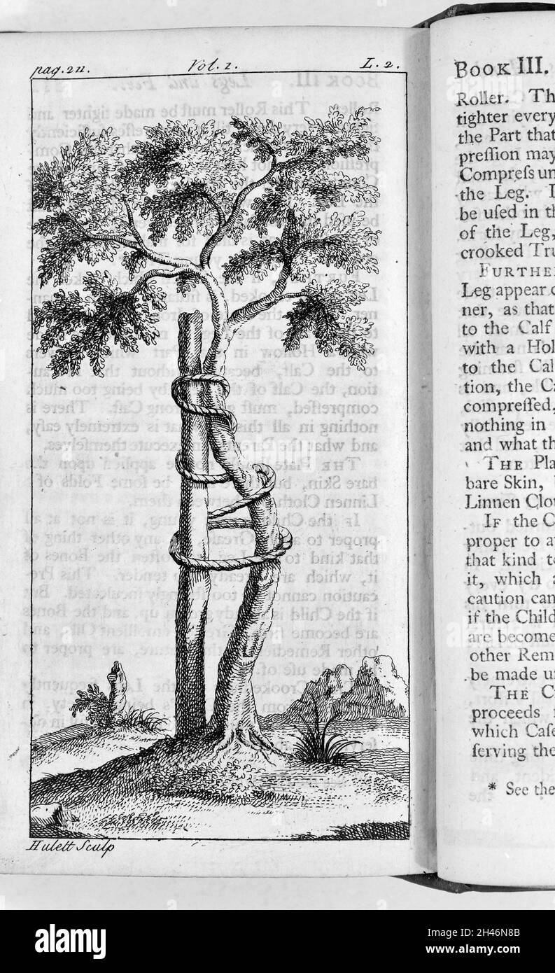 Nicolas Andry de Boisregard, Orthopedia, 1743 Stock Photo - Alamy