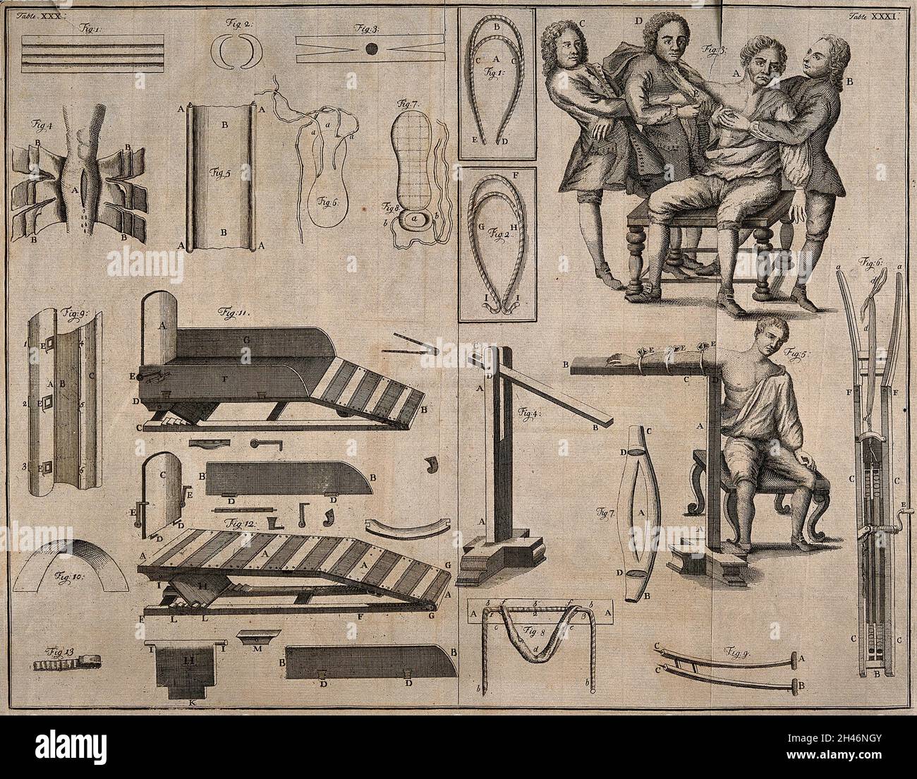 Surgical instruments. Engraving with etching Stock Photo - Alamy