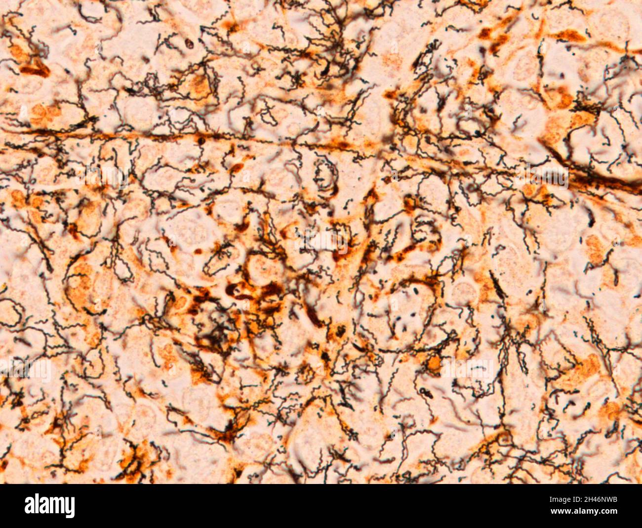 Spirochete presentation in inguinal lymph node section Stock Photo - Alamy