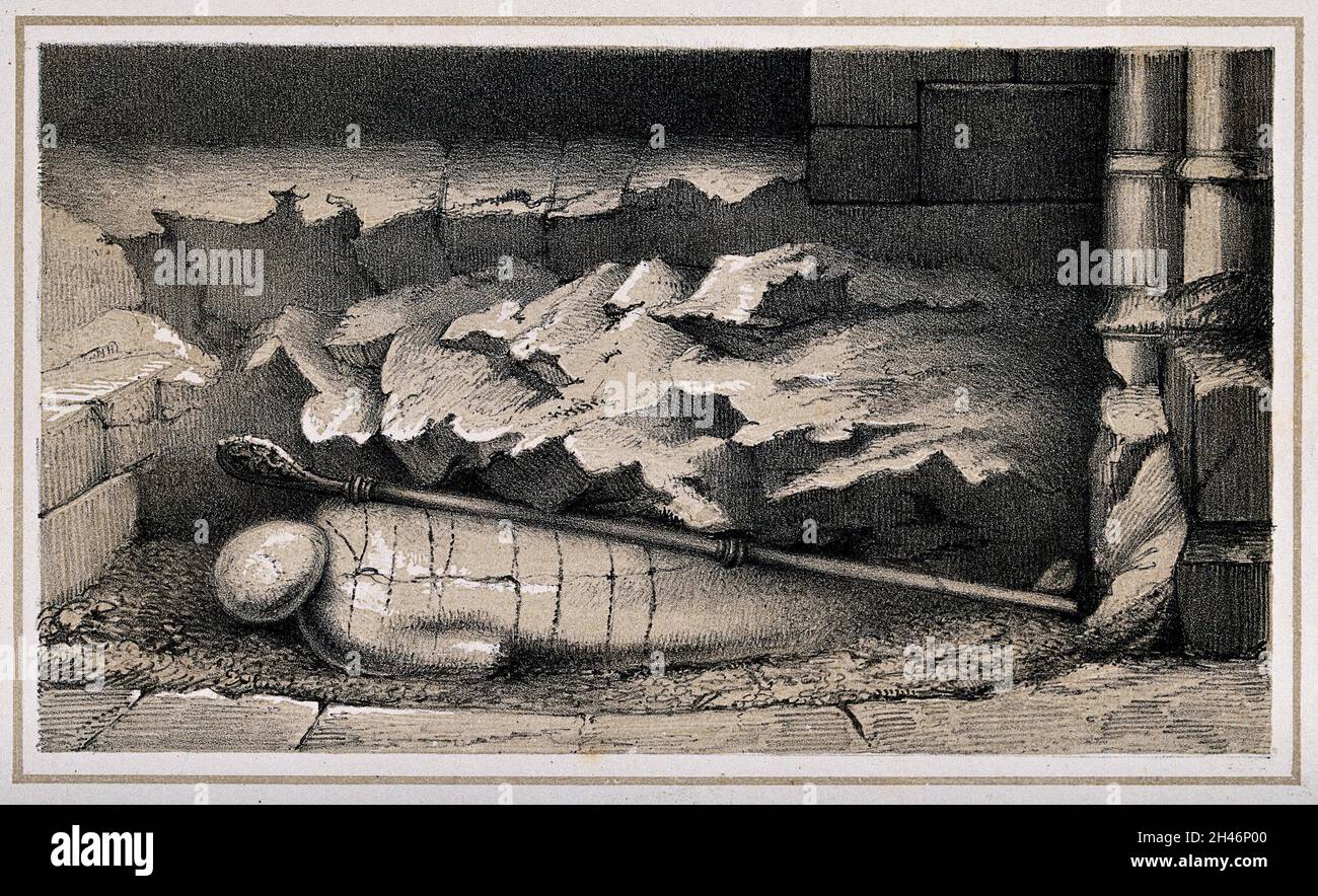 An exhumed mummy in St. Stephen's Crypt in Westminster. Chalk ...