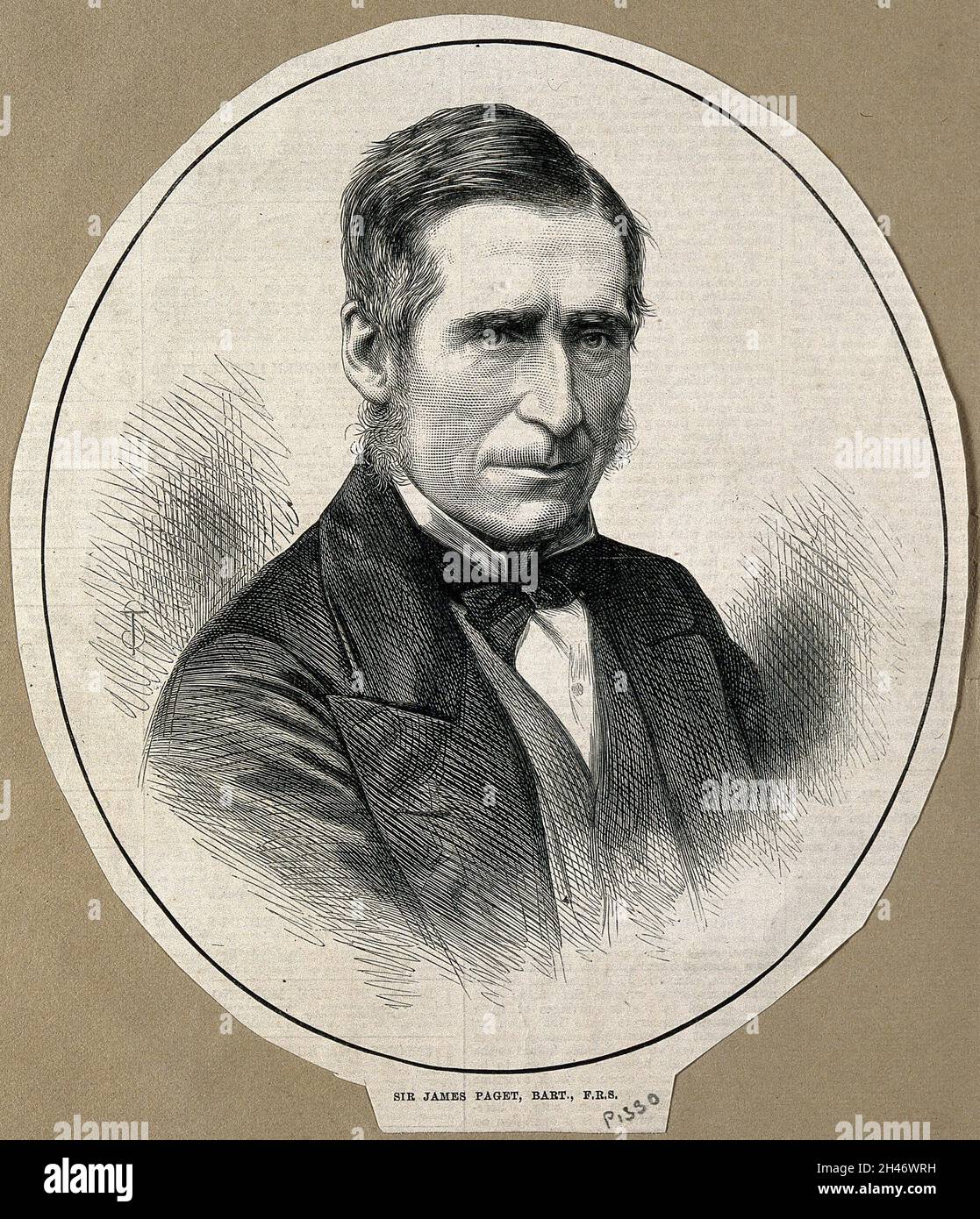 Sir james paget hi-res stock photography and images - Alamy