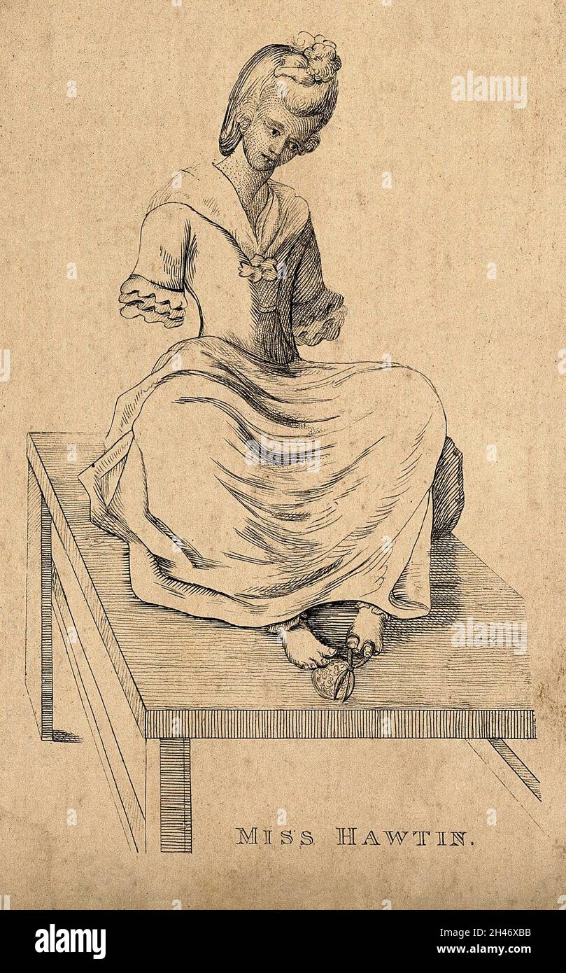 Born without arms hi-res stock photography and images - Alamy