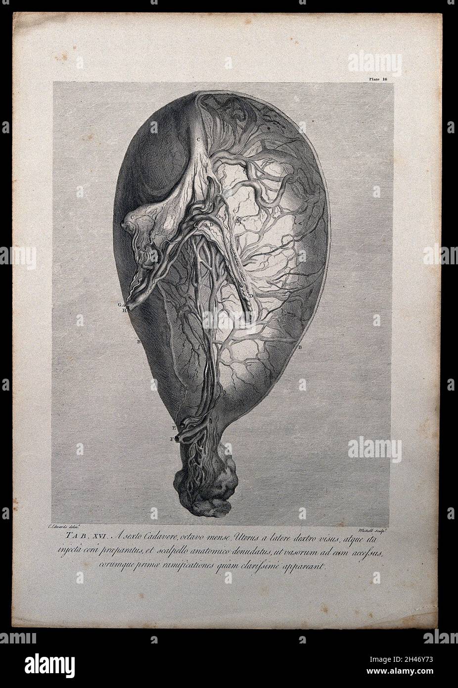 Dissection of the pregnant uterus and eight months, showing the uterine ...