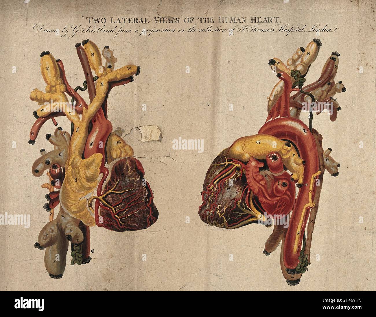 Two lateral views of the human heart. Coloured engraving by G. Kirtland ...