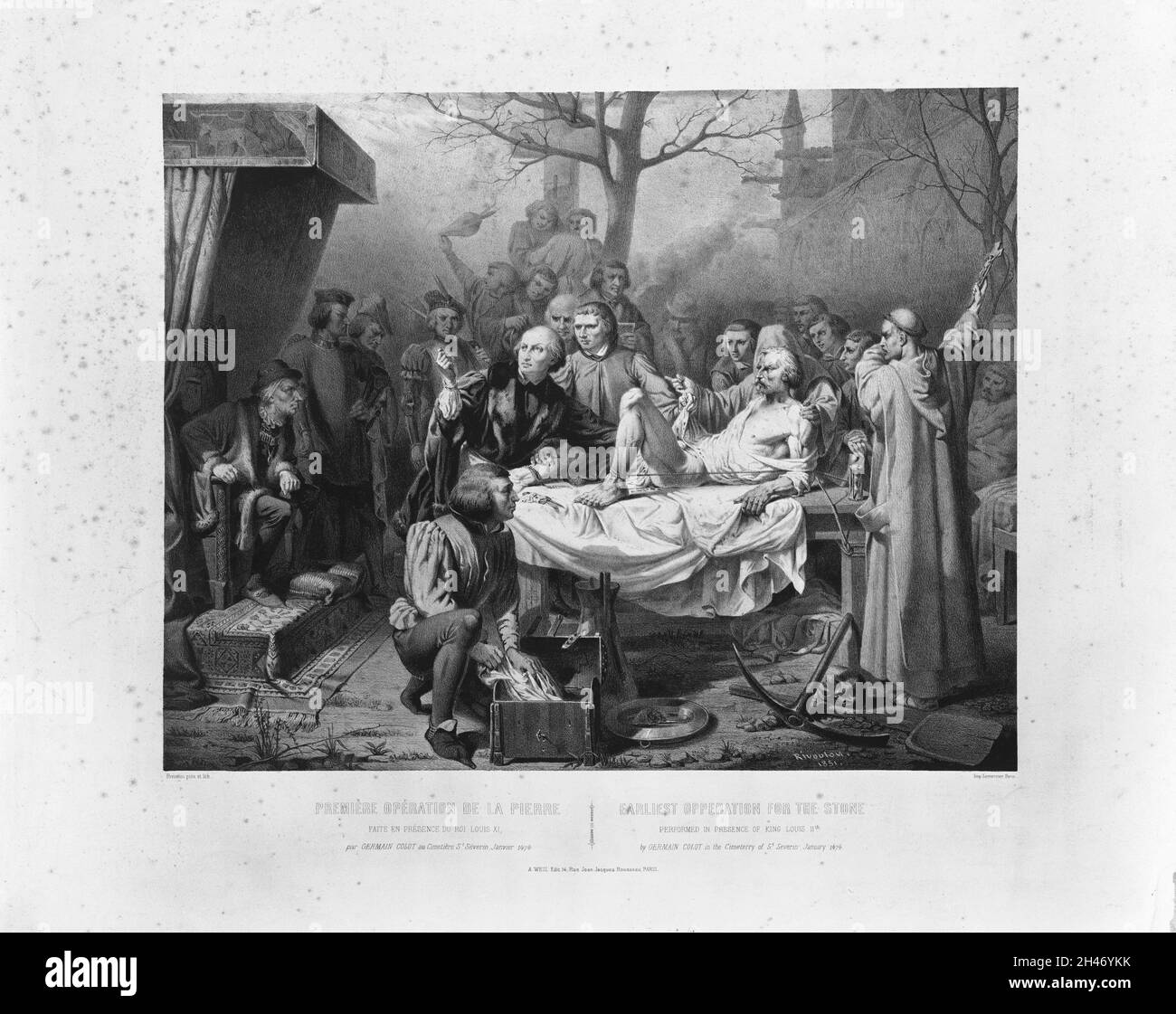 Bladder operation hi-res stock photography and images - Alamy