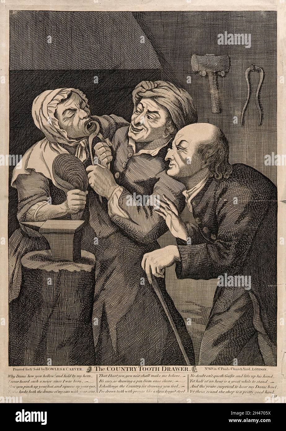 A rustic blacksmith turned tooth-drawer extracting a tooth from an ...