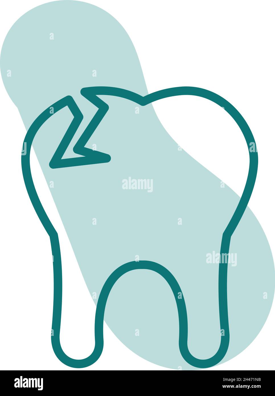 Broken tooth, illustration, vector, on a white background Stock Vector ...