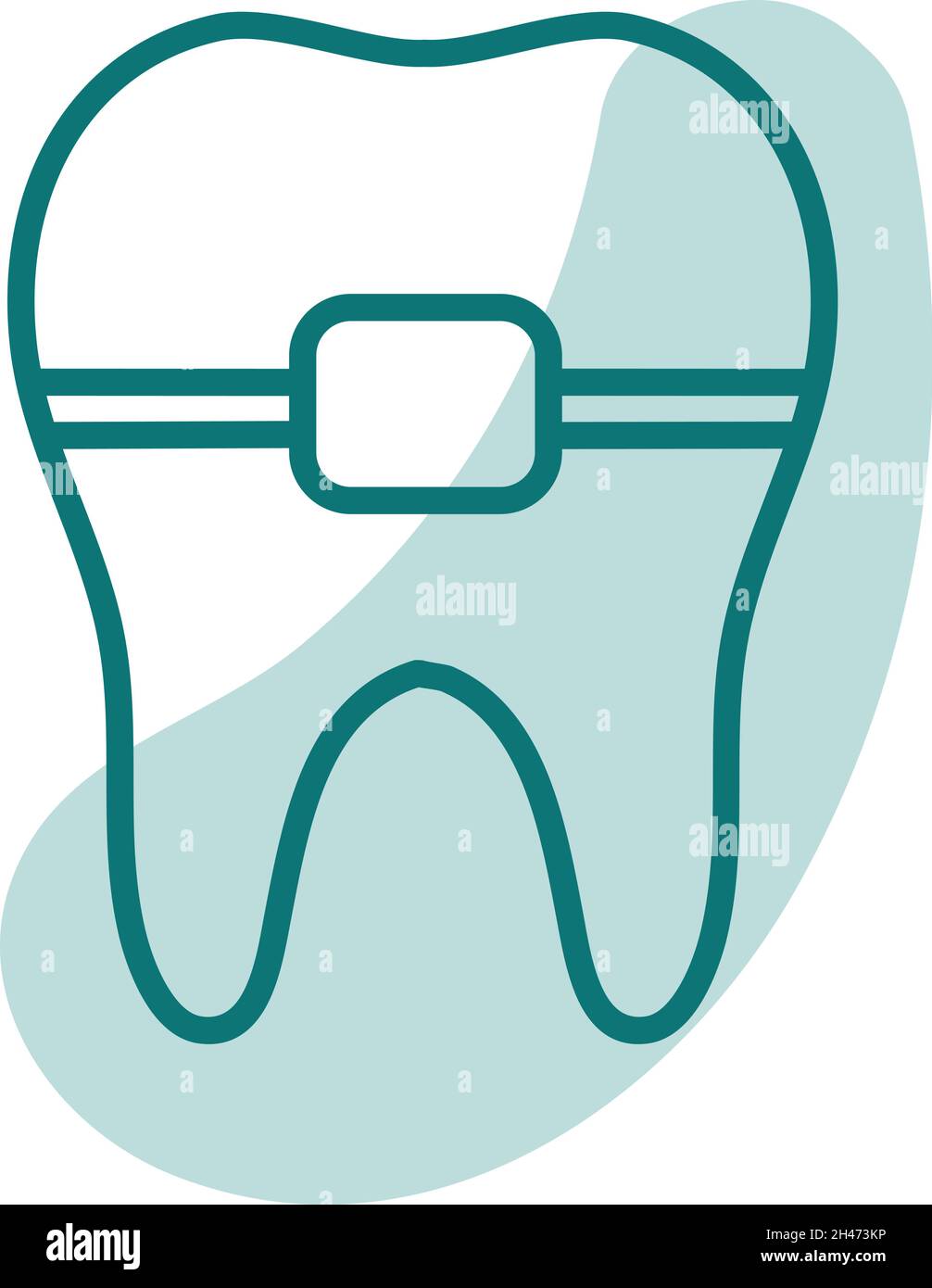 Tooth retainer, illustration, vector, on a white background Stock ...
