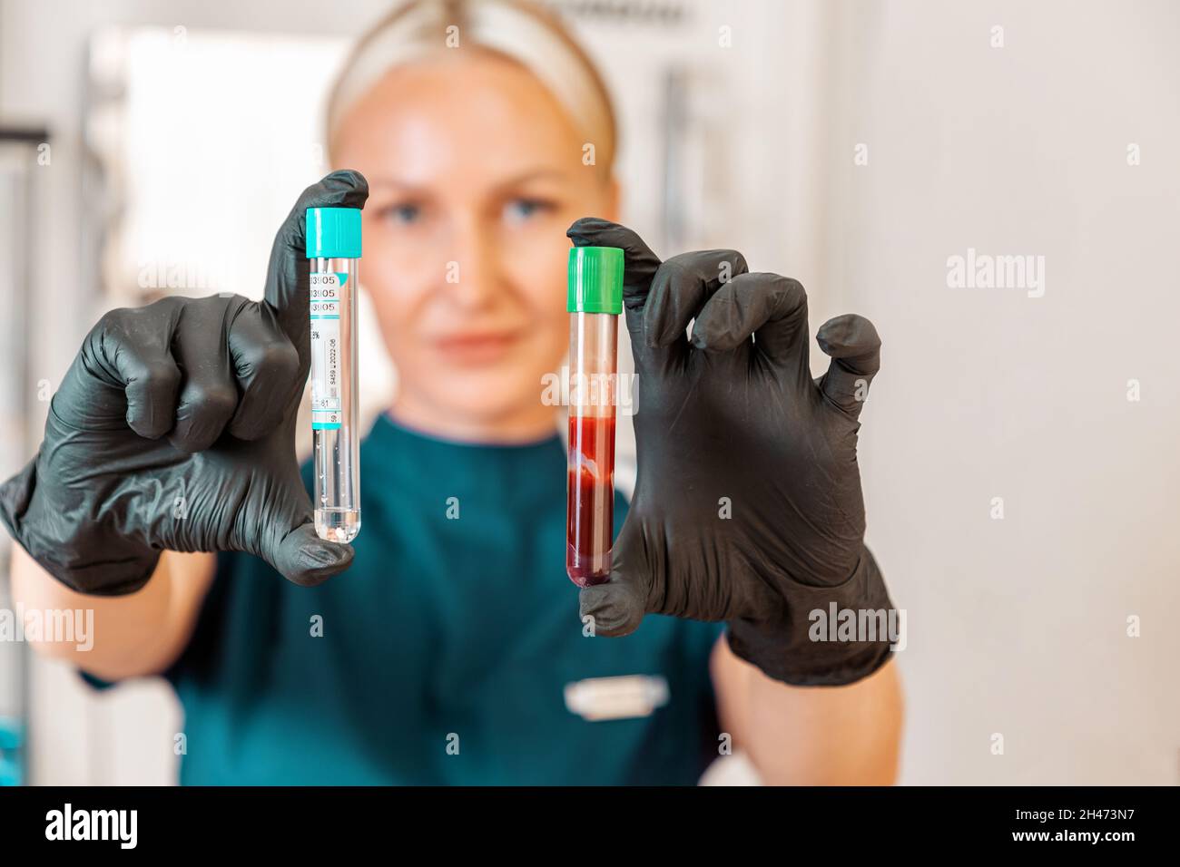 Plasmolifting. Preparation of blood for beauty injections. Doctor shows ...