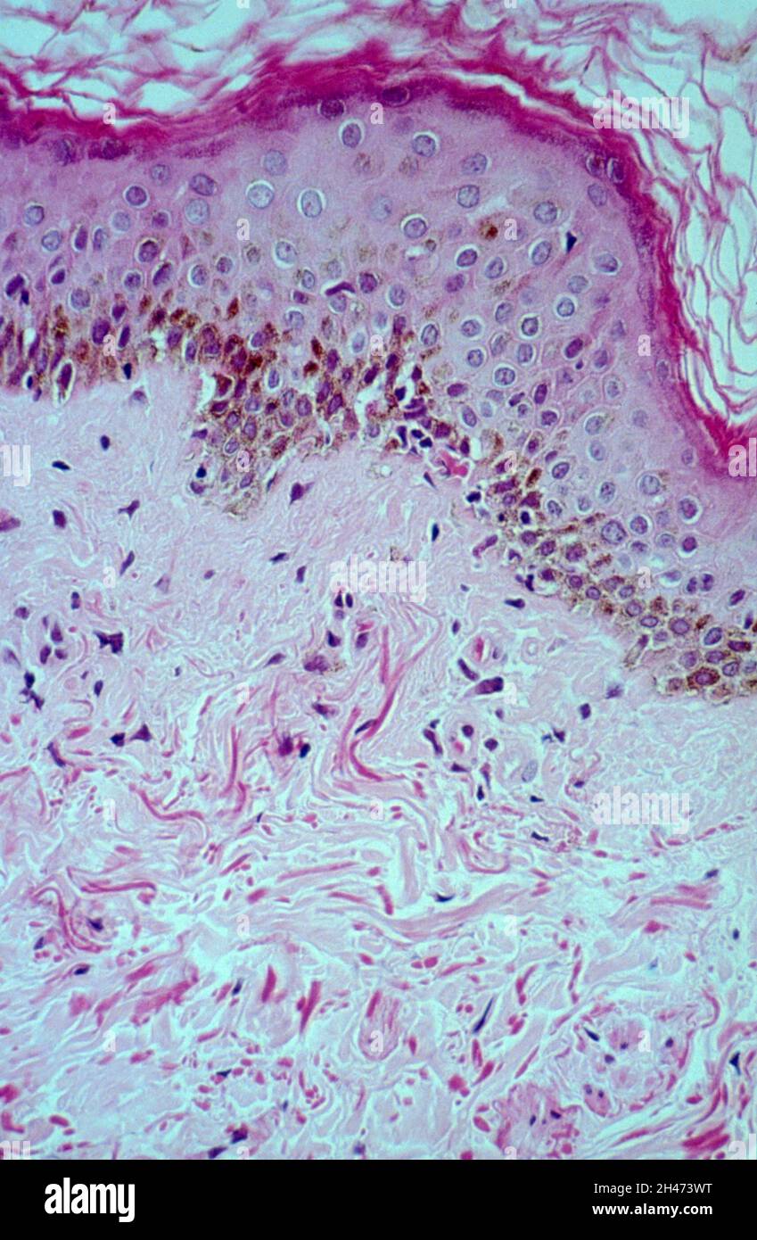 Historical disease studies hi-res stock photography and images - Alamy