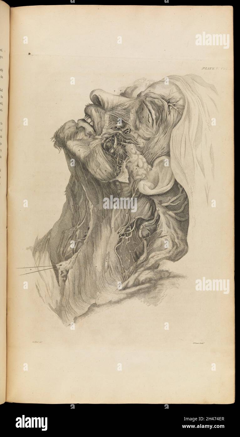 Human head dissection Stock Photo - Alamy