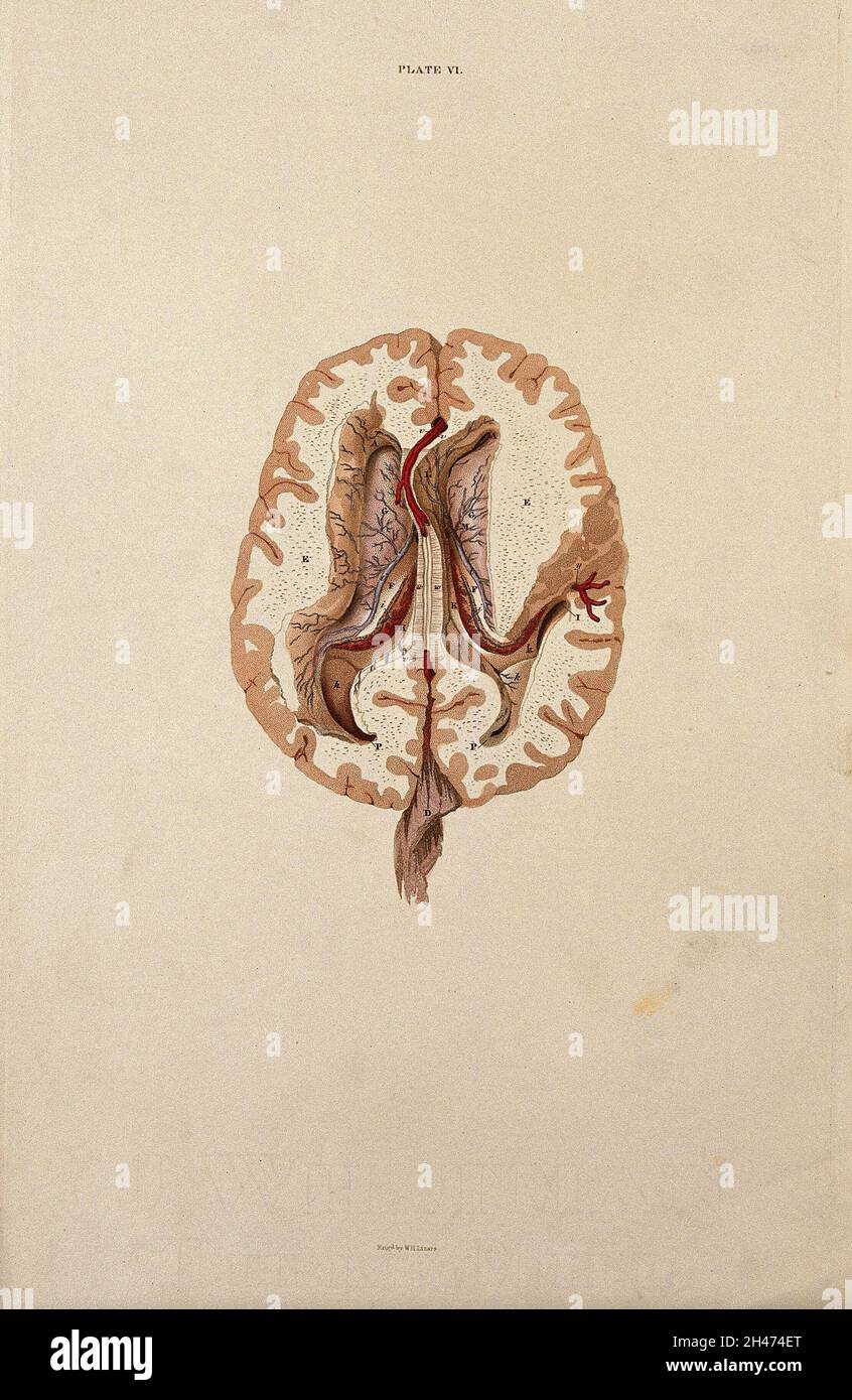 Brain: horizontal section showing lateral ventricles. Coloured line ...