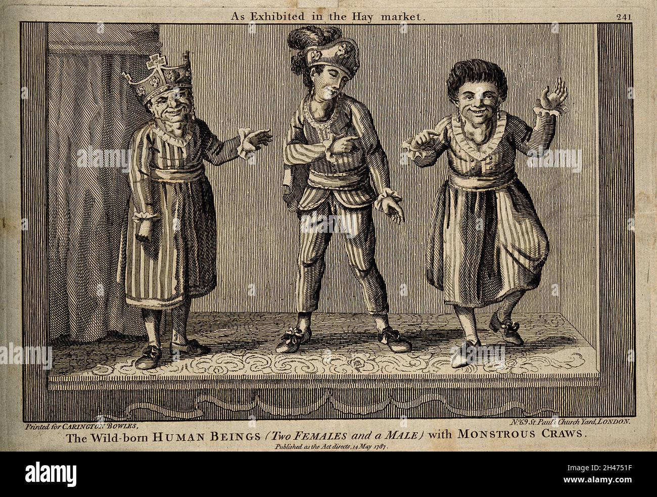 Three wild born people, all with goitre. Engraving, 1787 Stock Photo ...