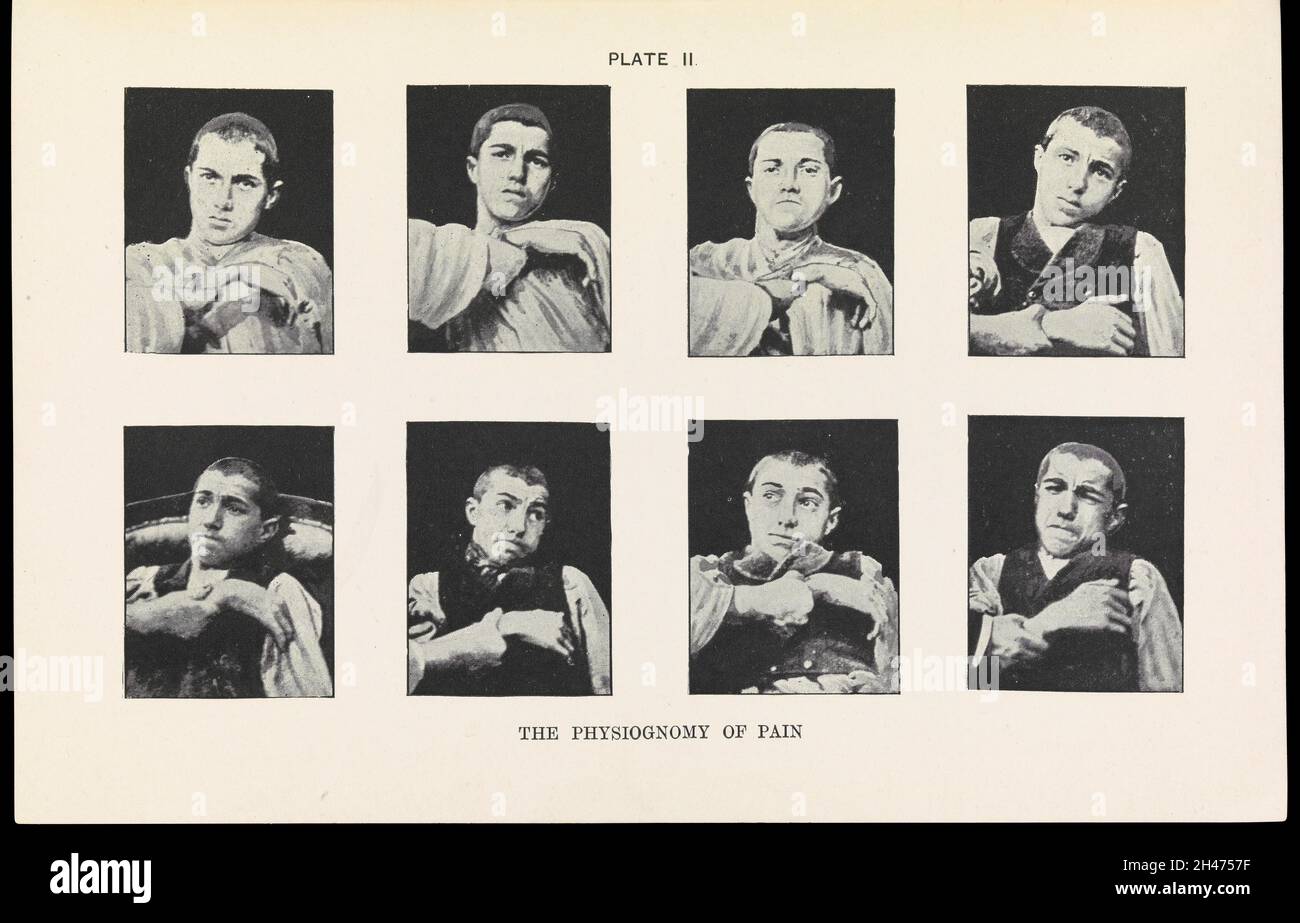 The Physiognomy of Pain, Plate II, Fear by A. Mosso Stock Photo - Alamy