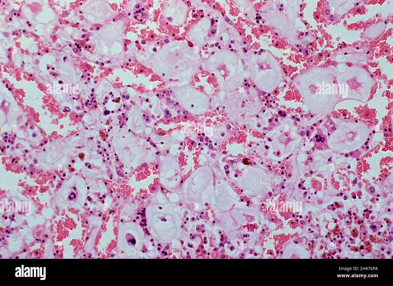 Cellular transformation hi-res stock photography and images - Alamy