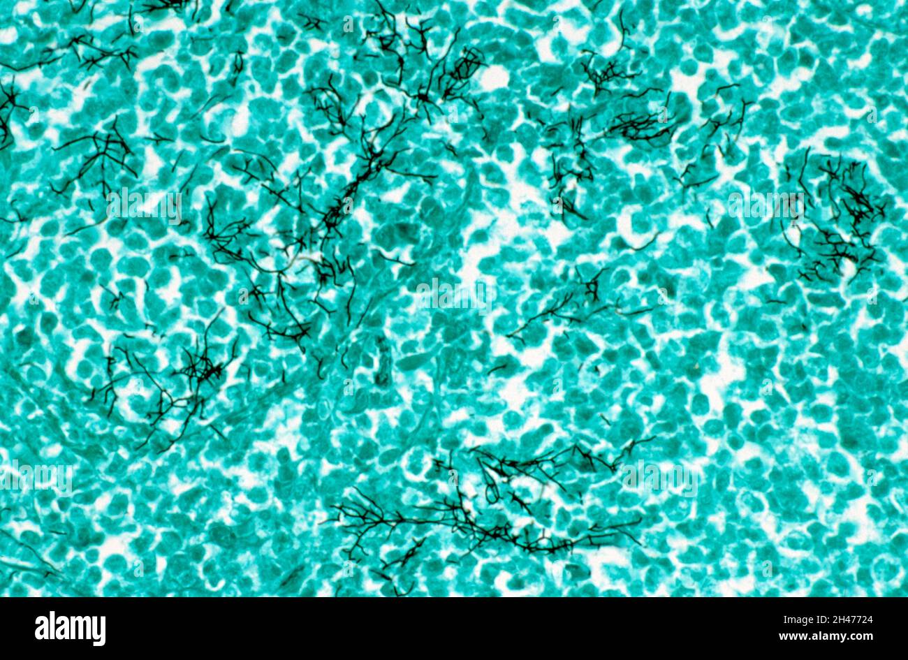 Nocardiosis High Resolution Stock Photography and Images - Alamy